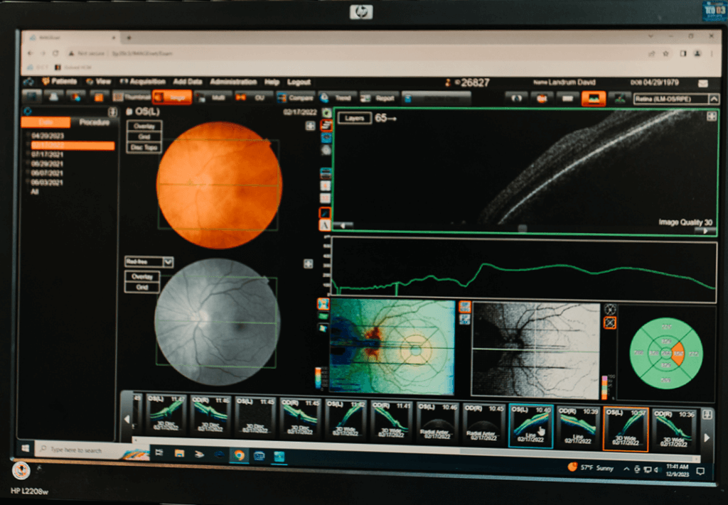 Eye Exams - Nilsen Eye Care